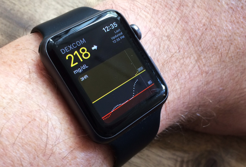 Why Is Continuous Glucose Monitoring So Important Diabetes